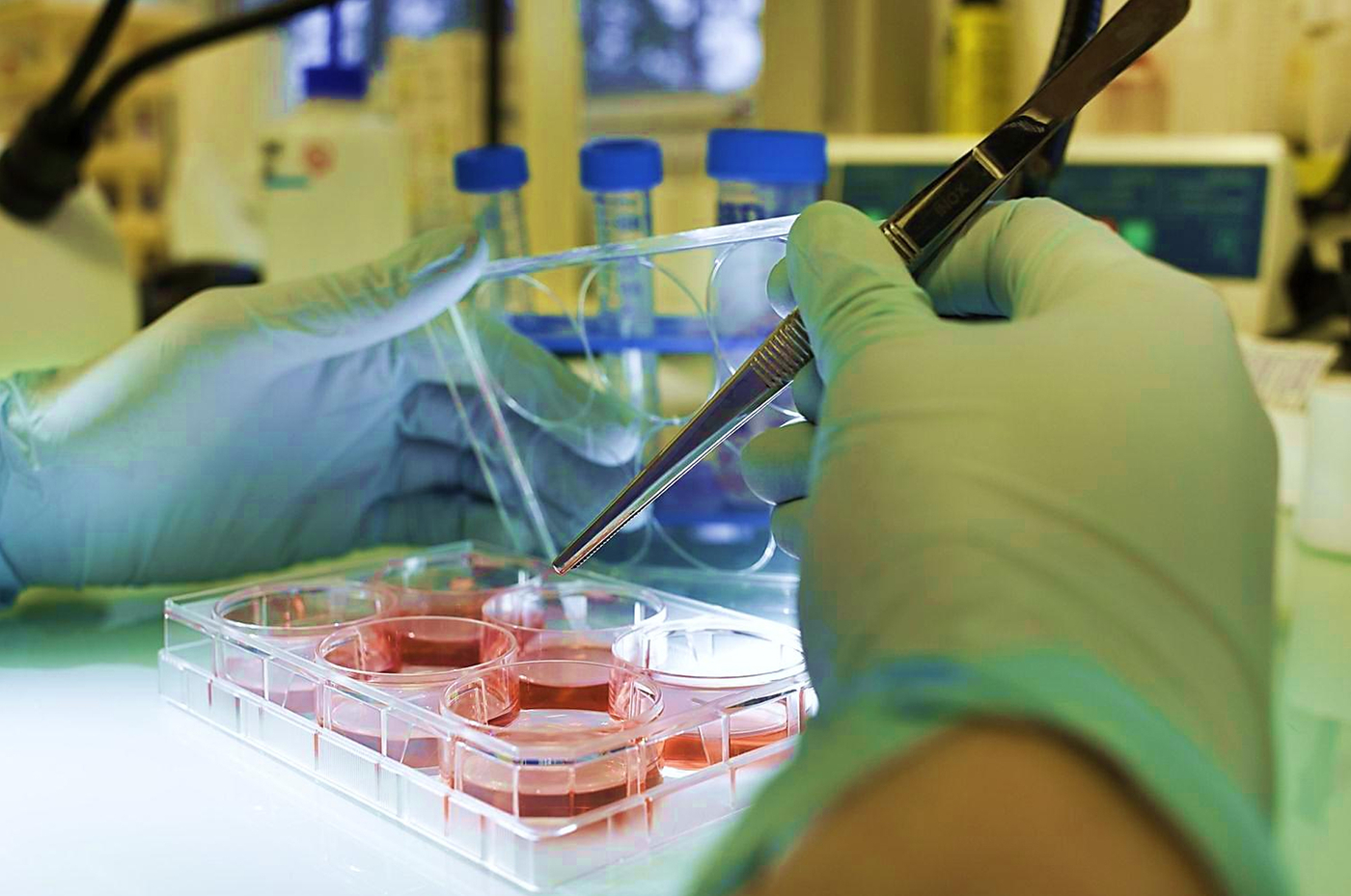 La France à la pointe de la recherche en cancérologie | enseignementsup-recherche.gouv.fr